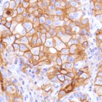 PD-L1/CD274 (SP142) | Discovery Sci